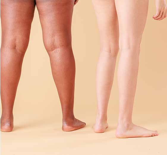 How to Get Rid of Ingrown Hair: Hot Compress Methods – Tress Wellness