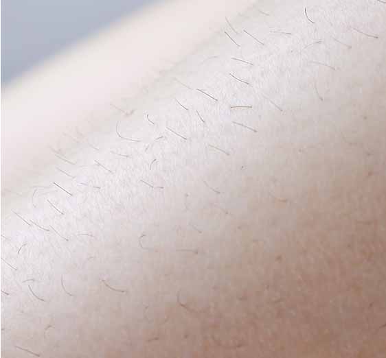 How to Get Rid of Ingrown Hair: Hot Compress Methods – Tress Wellness